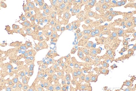 Fabp1 Antibody 68227 1 Ig Proteintech