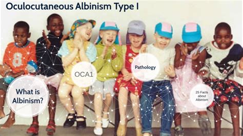 Oculocutaneous Albinism Type 4