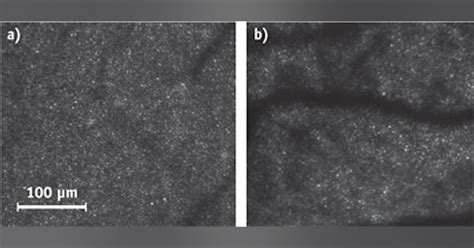 Ophthalmologymicroscopyoptical Coherence Tomography Novel Ophthalmic