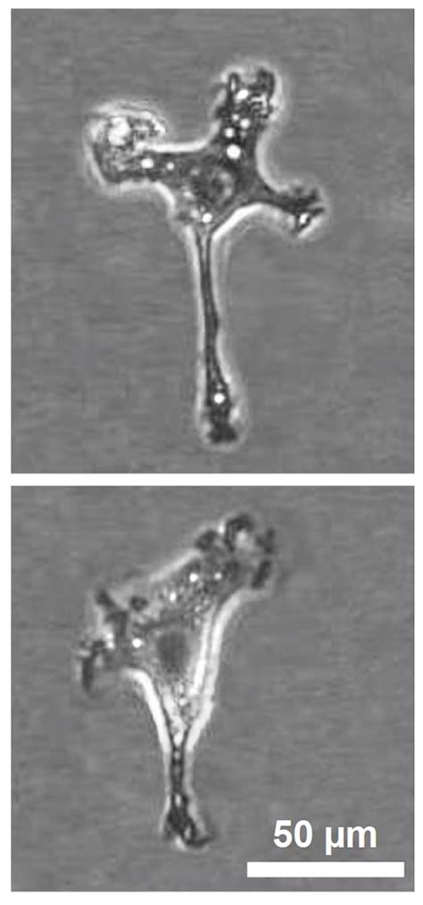Macrófagos El Decisivo Papel De Las ‘células Tragonas Del Sistema Inmunitario En Nuestra Salud