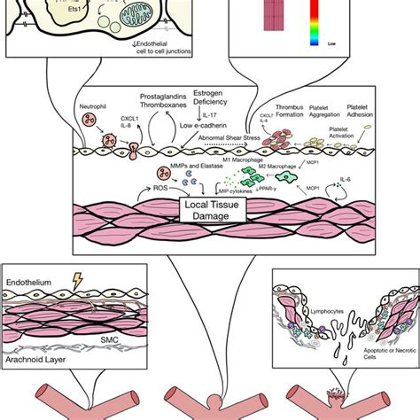 Historical Timeline Of Advancements In Cerebral Aneurysm Diagnosis And