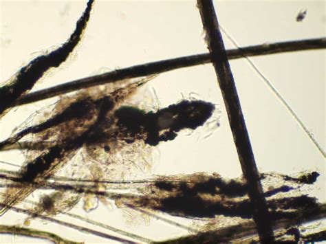 What Are Trichograms And What Use Are They In Diagnoses