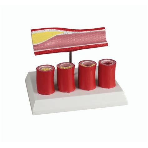 Artery Model With Sections Health And Care