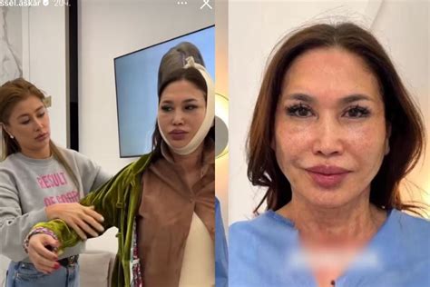 2 миллион 320 мың теңге Танымал актриса Әсел Асқар анасына ота