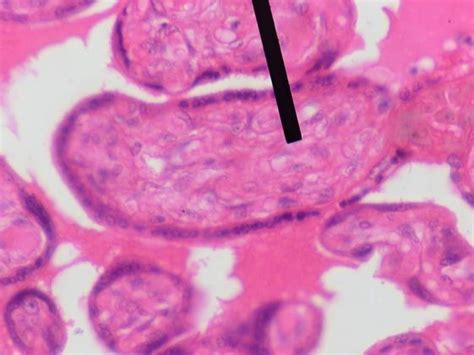 Difference Between Epithelial And Mesenchymal Cells Compare The