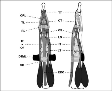 Mri Of Finger Tendons Radiology Key