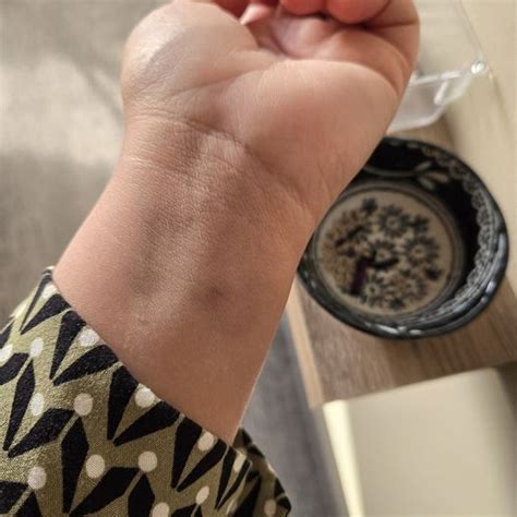 Acupuncture Acupuncturist Eastasianmedicine Chinesemedicine