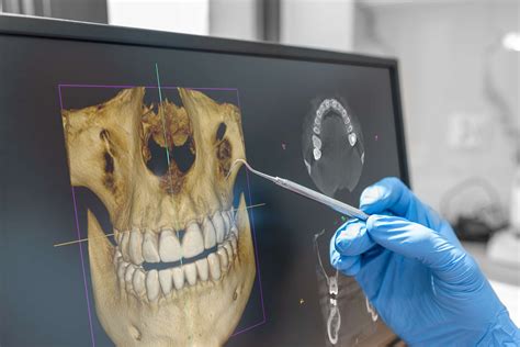 3d Dental Imaging Cbct Orthodontists Associates Of Wny