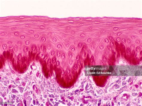 Epitheliumstratified Squamous Epithelium Lining The Esophagus 100x High