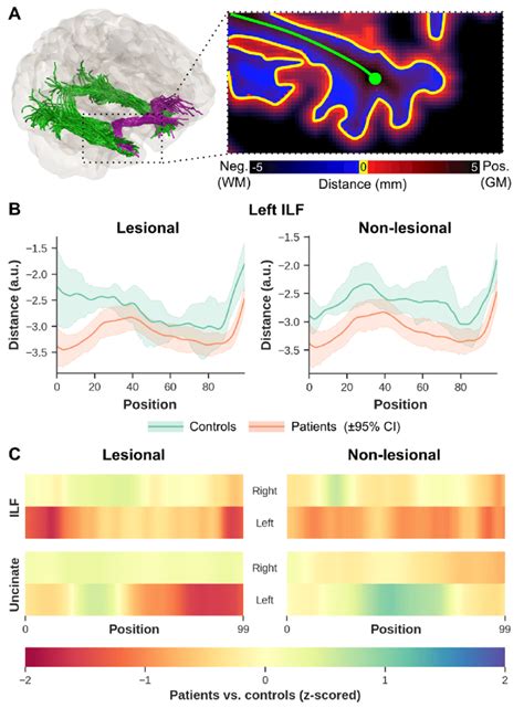 Wm Bundle Sampling Analysis Show Variability In The Mean Distance