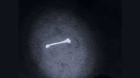 Phasmophobia Bone Evidence How To Find And Use Bones