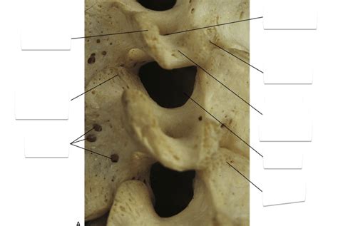 Diagram Of Intervertebral Foramen Ivf Quizlet