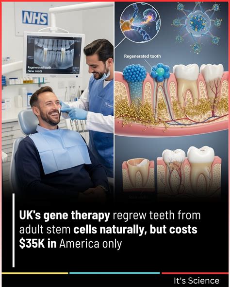 Its Uks Gene Therapy Regrew Teeth From Adult Stem Cells Naturally