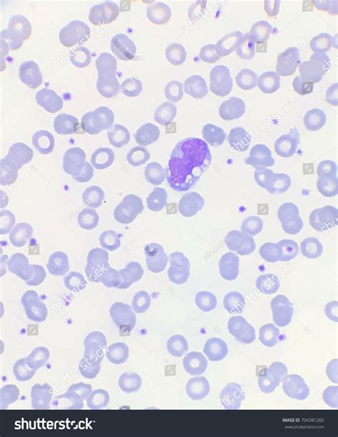 Normal Monocytes