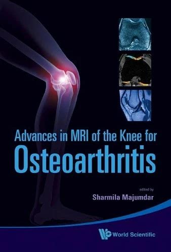 Ehsan Saadat Advances In Mri Of The Knee For Osteoarthritis Relié Eur 141 00 Picclick Fr
