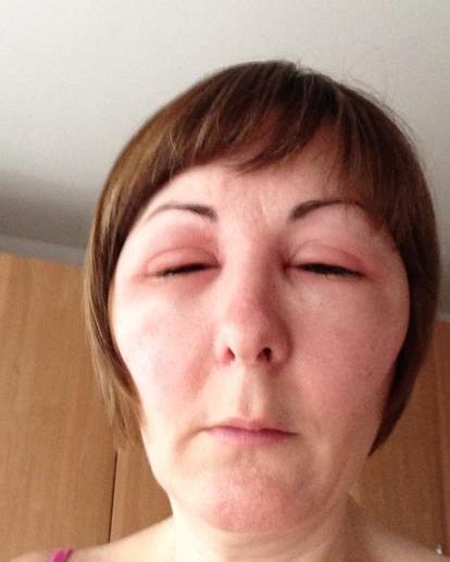 This Is Why Its Critical To Patch The Patch Test Kit Facebook