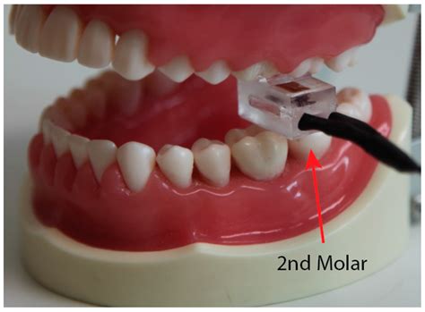 Novel Low Cost Sensor For Human Bite Force Measurement