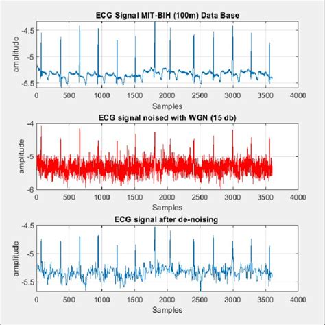 Represent The Ecg Signal The Noisy Signal And The Denoise Signal Download Scientific Diagram