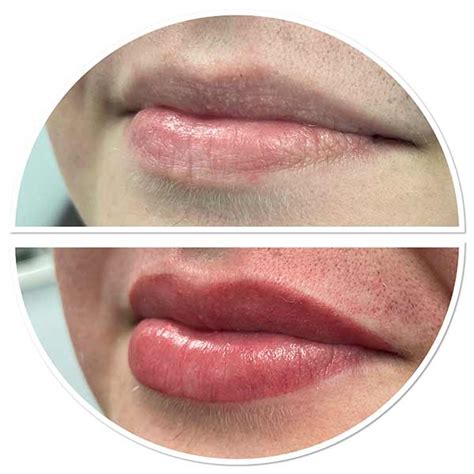 Semi Permanent Lip Blush Precision Beauty Worthing