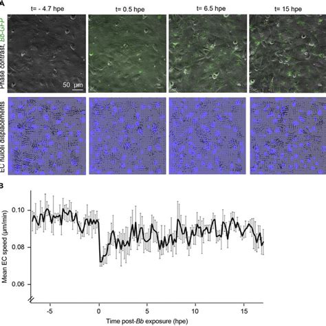 Analysis Of Hmec 1 Cell Motility Pre And Post Exposure To Bb Gfp A