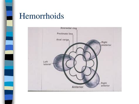 Ppt The Rectum And You Powerpoint Presentation Id473298