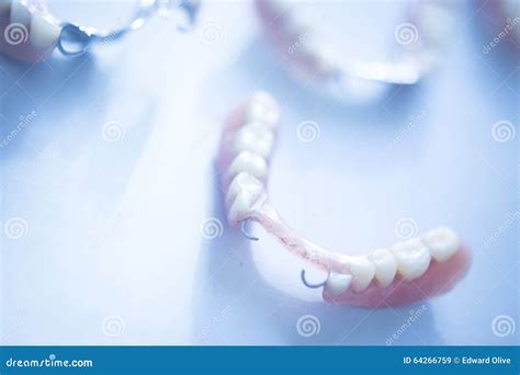 Removable Partial Denture On White Background Royalty Free Stock Image