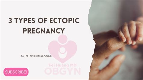 3 Types Of Ectopic Pregnancy Ectopic Pregnancy Pregnancy Obstetrics