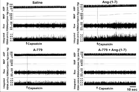 Representative Recordings Showing The Effects Of Pvn Microinjection Of Download Scientific