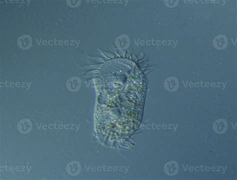 Ciliates Under Microscope