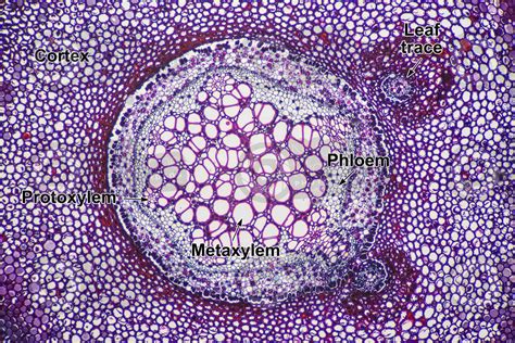 Dicranopteris Sp Forkedfern Rhizome Protostele Transverse Section