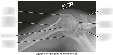 Diagram Inferosuperior Axial Shoulder X Ray 2018 Diagram Quizlet