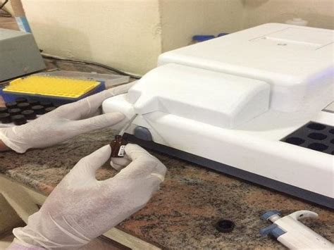 Testing The Samples In Analyzer Download Scientific Diagram