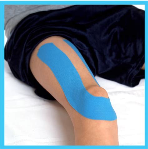 Patellar Tendonitis Pediatrics Kinesio