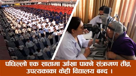 पछिल्लो एक सातामा आँखा पाक्ने संक्रमण तीव्र उपत्यकाका केही विद्यालय