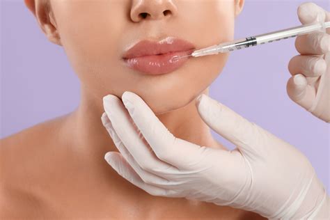 Preenchimento Labial Com ácido Hialurônico Dra Marcela Uehara