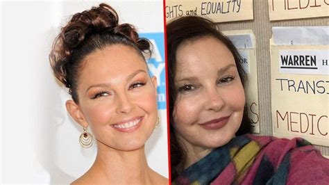 Ashley Judd Was Attacked For Botox And The Truth Behind The Aesthetic