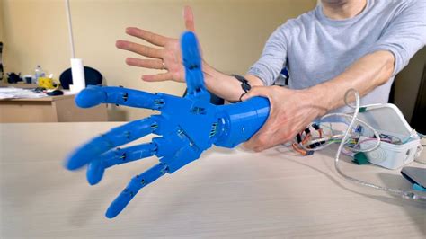Technologythursday Bionic Arm Youtube