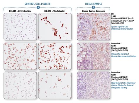 信頼の置ける免疫組織化学染色 Ihc 結果を得るための試薬 Cell Signaling Technology