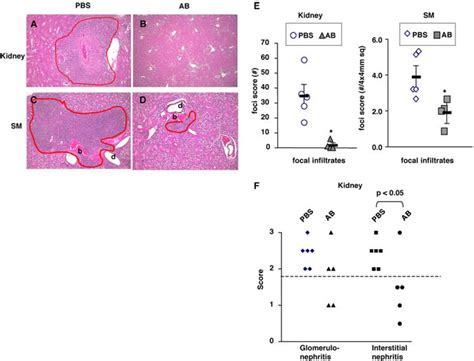 B Cell Depletion With Anti Cd79 Mabs Ameliorates Autoimmune Disease In