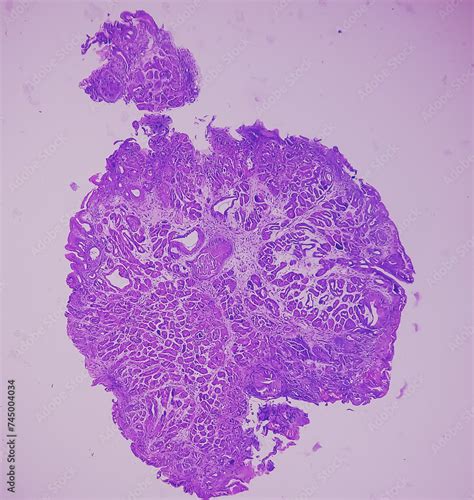 Gastric Body Tissue Endoscopic Biopsy Section Show Gastric Mucosa