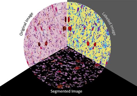 Imageprocessing Ai Deeplearning Machinelearning Brain