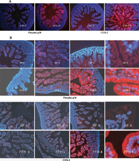 Figure 3 From Lipopolysaccharide Induces Cyclooxygenase 2 In Intestinal