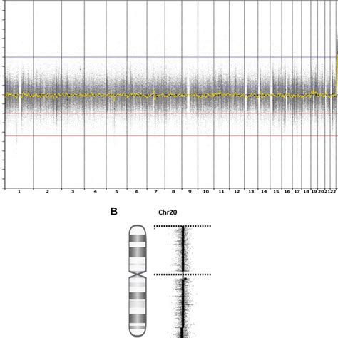 array comparative genomic hybridization on the dna extracted from