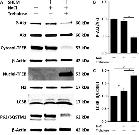 Trehalose Induced Tfeb Nuclear Translocation And Activation Of The