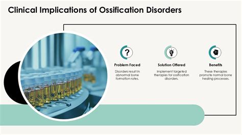 Clinical Implications Of Ossification Disorders Ppt Graphics Acp Ppt Slide