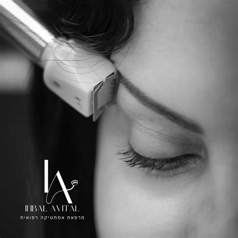 עינבל אביטל