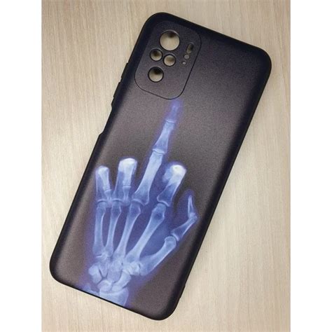 Silikonov Obal Pro Telefon Xiaomi Redmi Note S Obr Zkem Motiv Rentgen