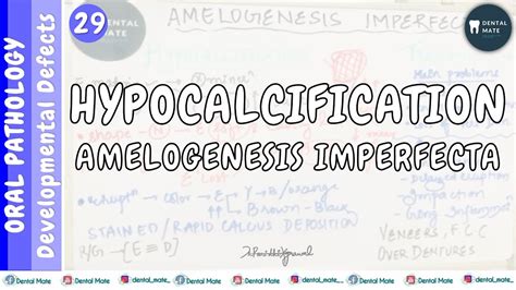 Hypocalcification Amelogenesis Imperfecta Treatment Part 5 Dr