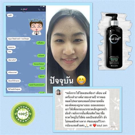 Beauty Annty แพ้เครื่องสำอาง เป็นมา 2 3 ปี