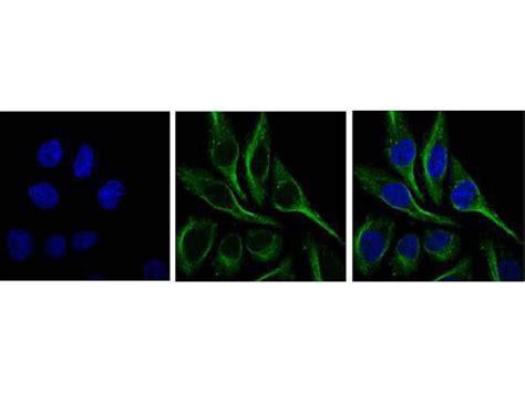 Sqstm1 Polyclonal Antibody Pa5 141006